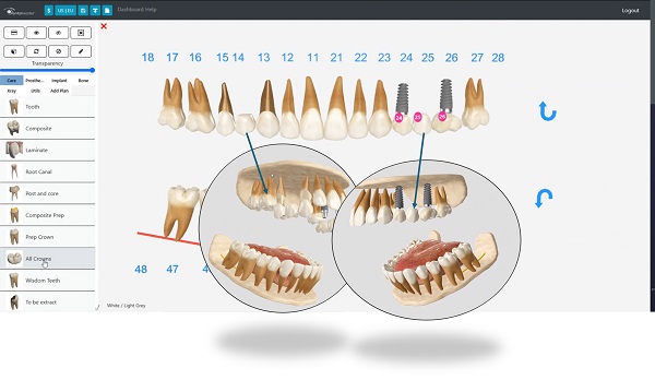 Dental Treatment Animation